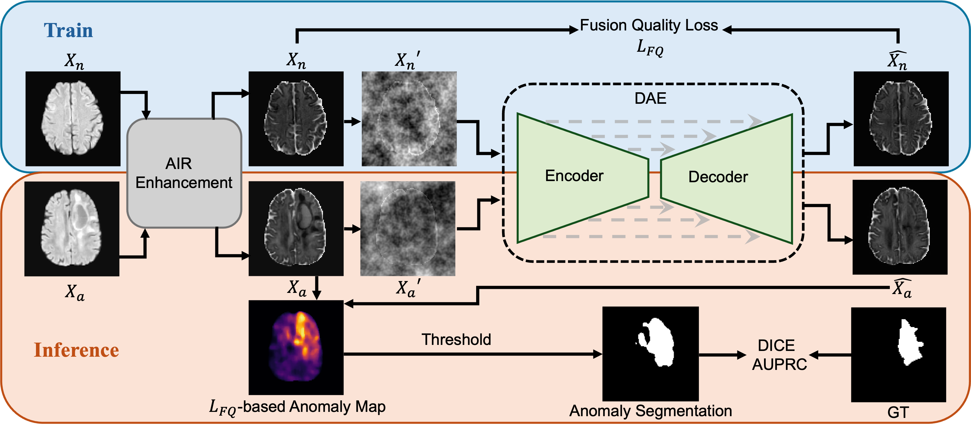 Rethinking Medical Anomaly Detection in Brain MRI: An Image Quality ...